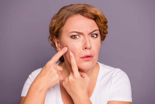 Menopausal Acne - How It Happens and What You Can Do About It